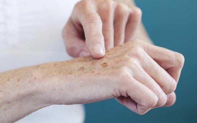 La cura delle mani inizia in inverno: come mantenerle sempre giovani e ...